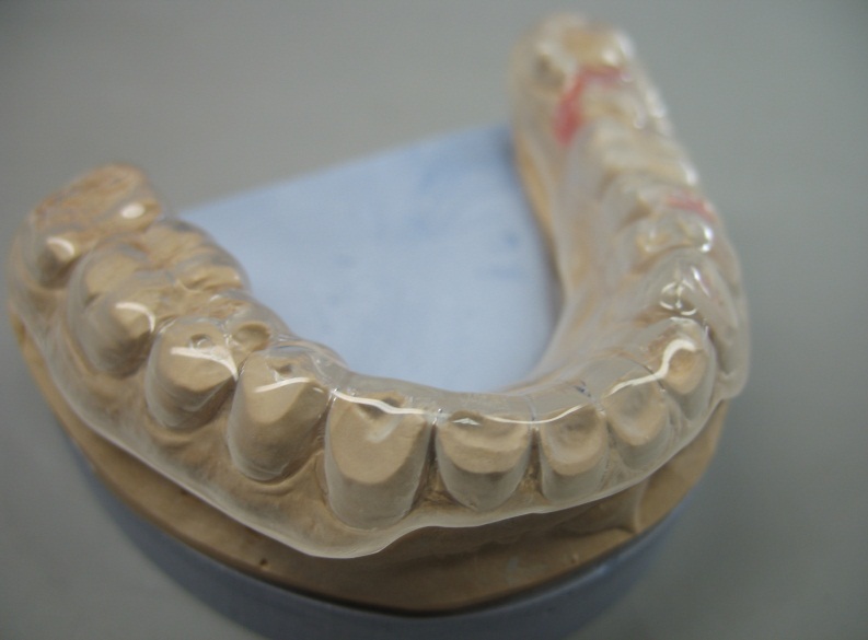 TRAITEMENTS – Dr. Maria Gabriella GIOVANDO